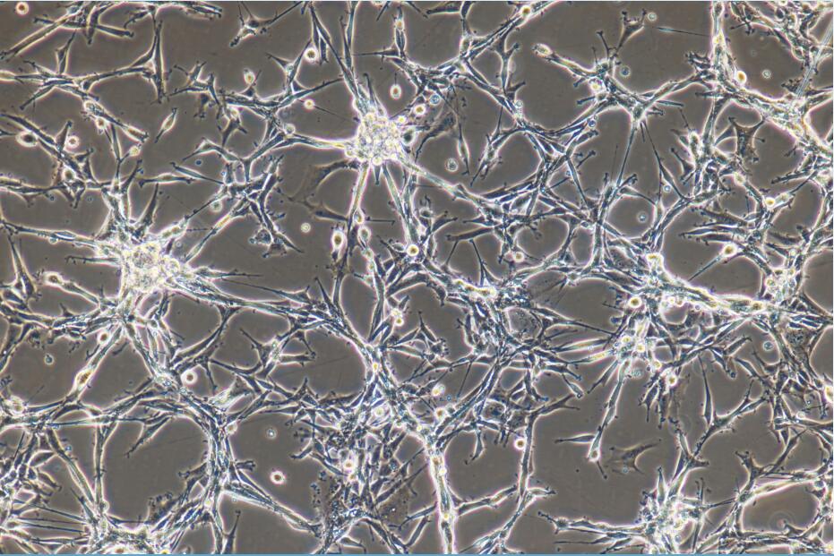 U118MG 人脑星形胶质母细胞瘤-原代细胞-STR细胞-细胞培养基-镜像绮点生物