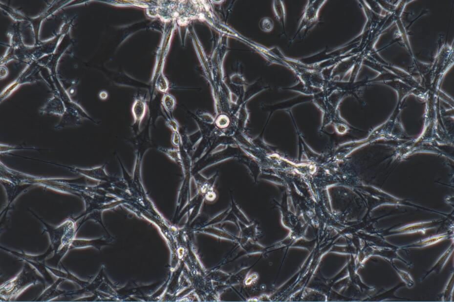 U118MG 人脑星形胶质母细胞瘤-原代细胞-STR细胞-细胞培养基-镜像绮点生物