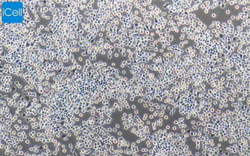 RIN-M5F 大鼠β胰岛素瘤细胞-原代细胞-STR细胞-细胞培养基-镜像绮点生物