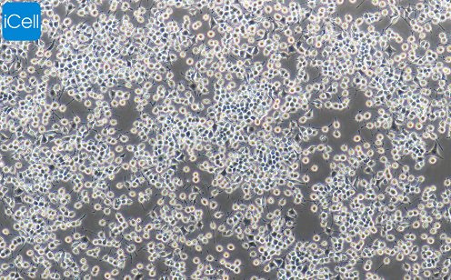 RIN-M5F 大鼠β胰岛素瘤细胞-原代细胞-STR细胞-细胞培养基-镜像绮点生物