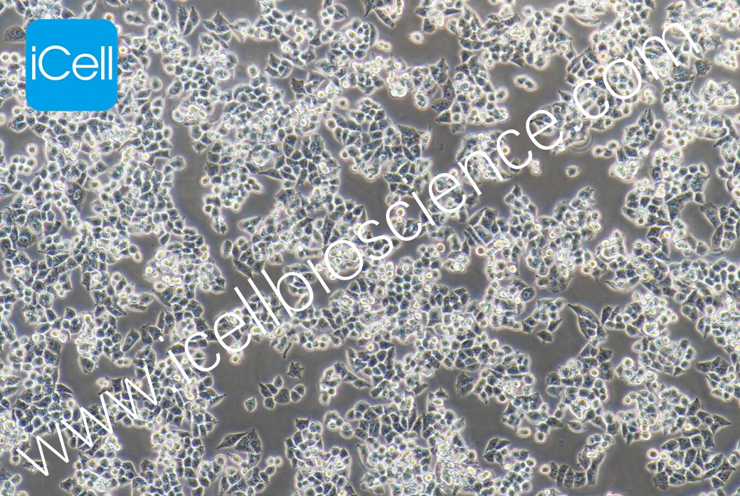 A2780 人卵巢癌细胞-原代细胞-STR细胞-细胞培养基-镜像绮点生物