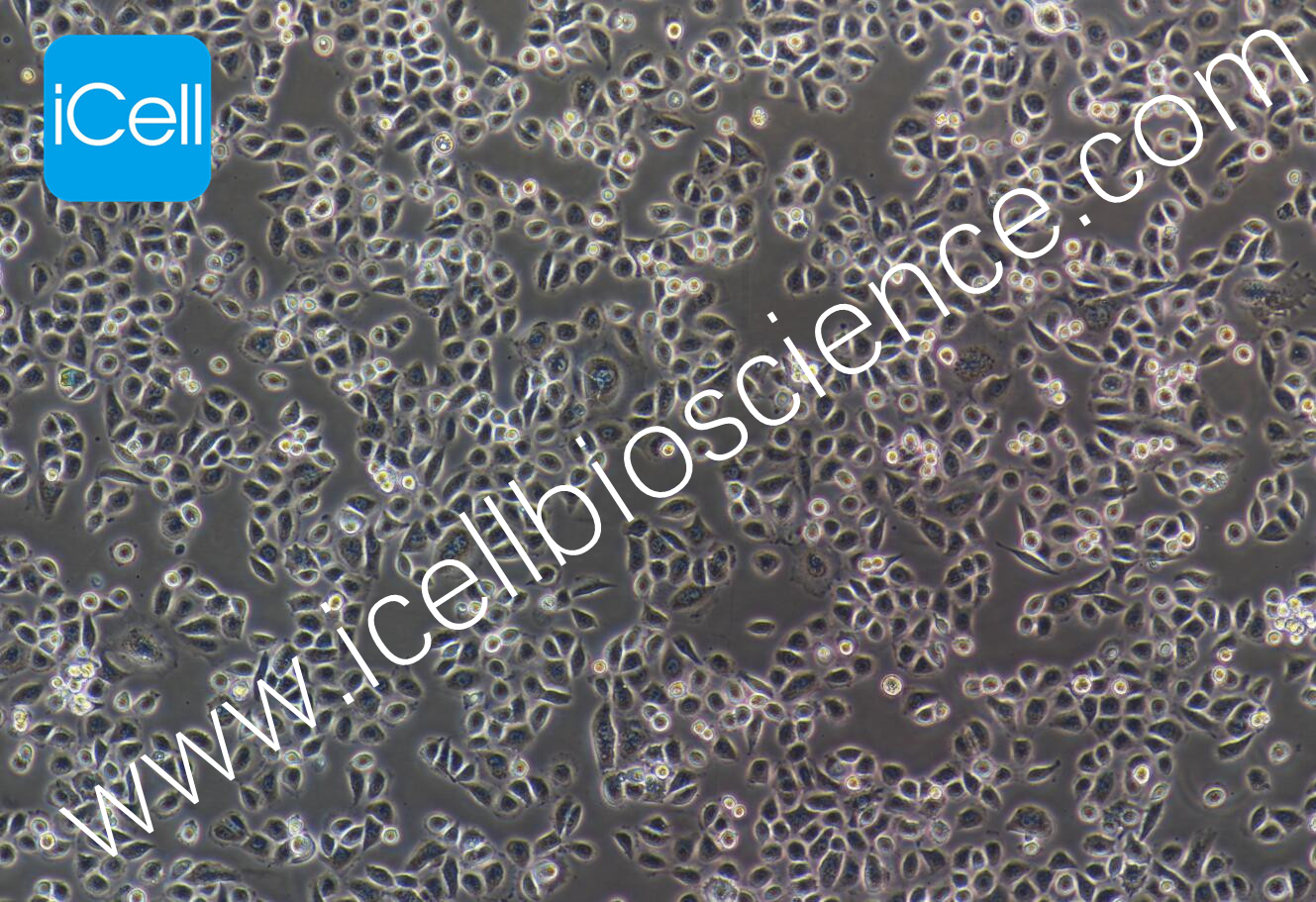 AsPC-1 人转移胰腺腺癌细胞-原代细胞-STR细胞-细胞培养基-镜像绮点生物