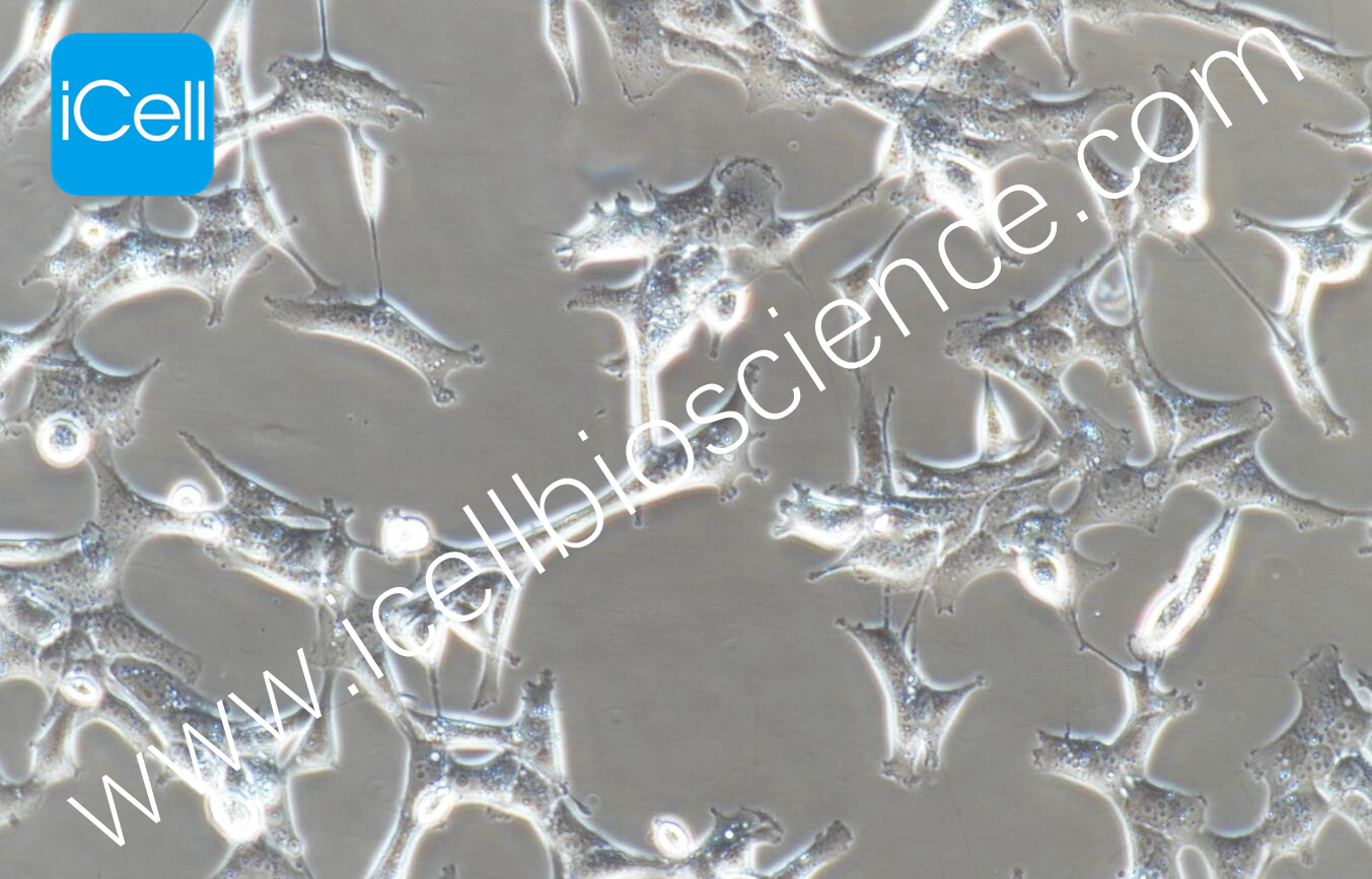 BCPAP 人甲状腺癌细胞（乳头状）-原代细胞-STR细胞-细胞培养基-镜像绮点生物