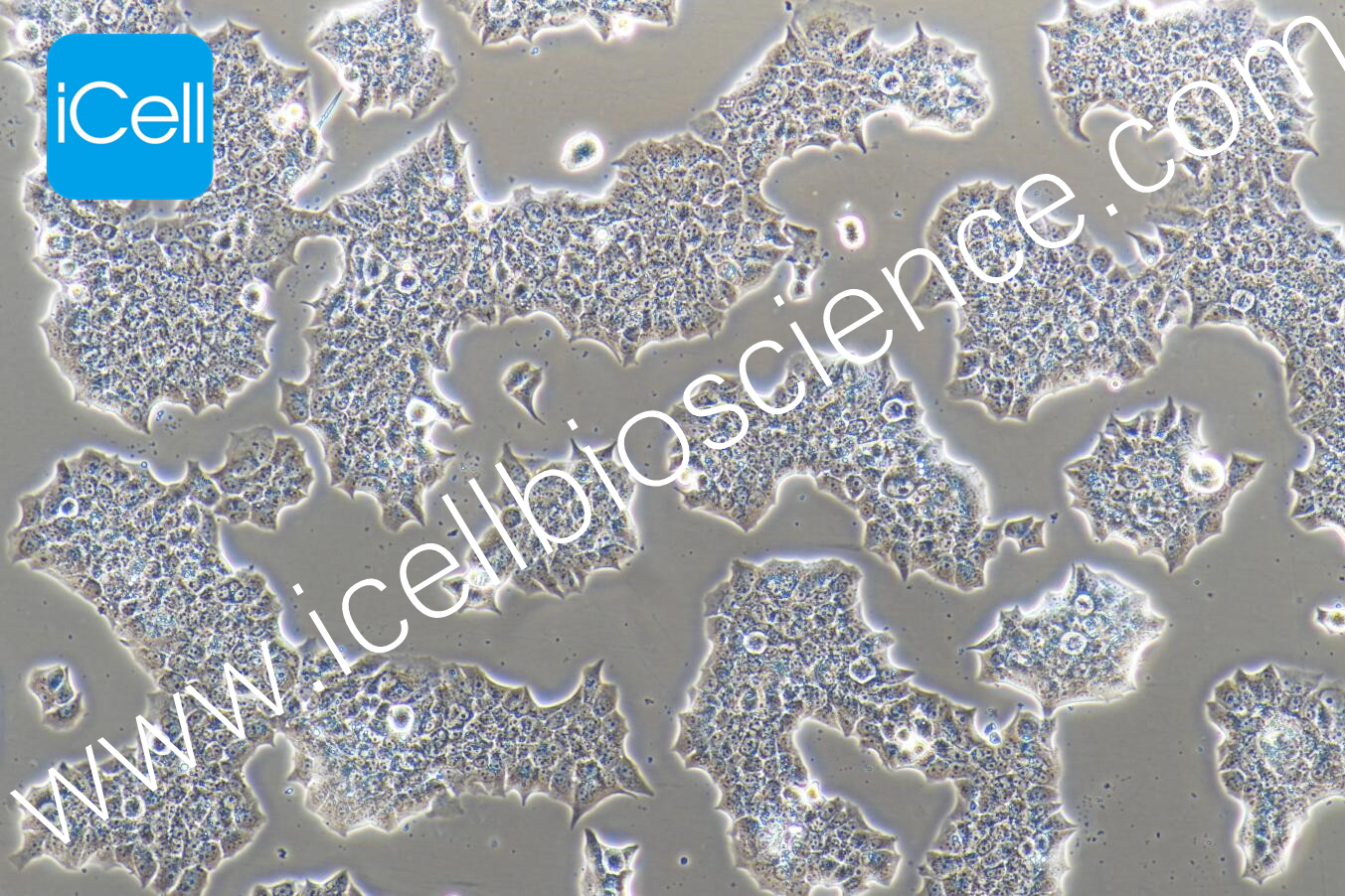 BT-474 人乳腺导管癌细胞-原代细胞-STR细胞-细胞培养基-镜像绮点生物