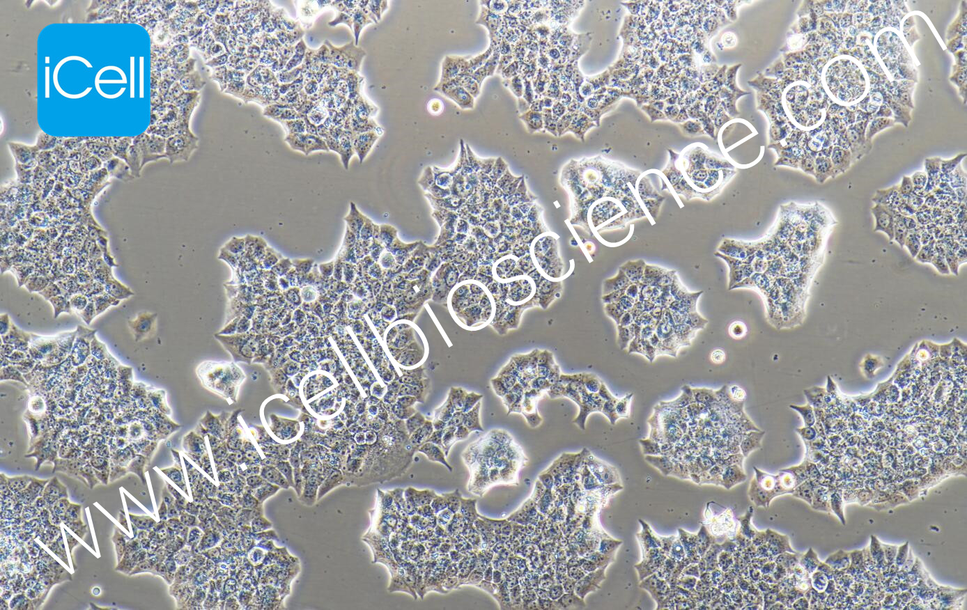 BT-474 人乳腺导管癌细胞-原代细胞-STR细胞-细胞培养基-镜像绮点生物