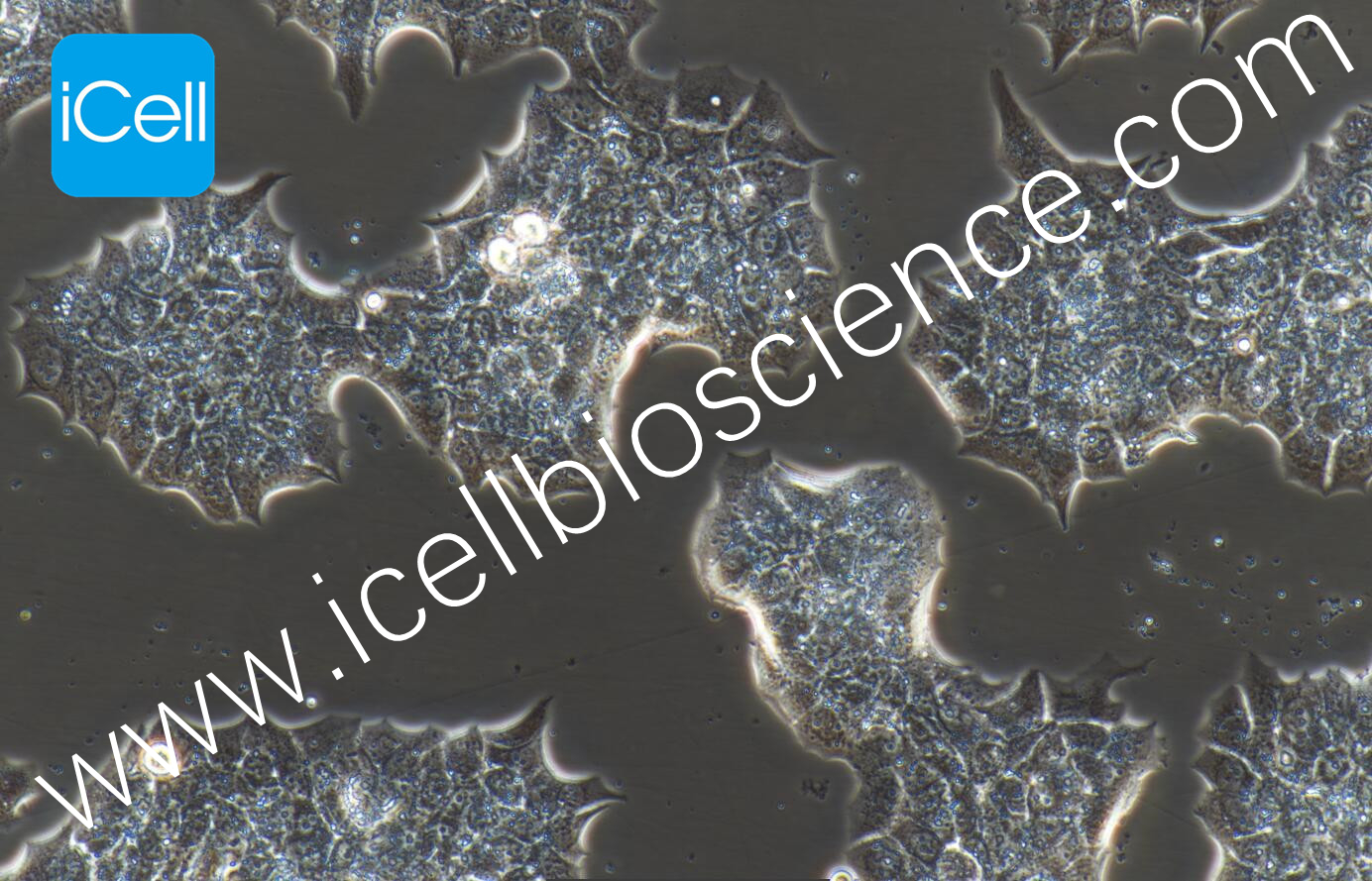 BT-474 人乳腺导管癌细胞-原代细胞-STR细胞-细胞培养基-镜像绮点生物