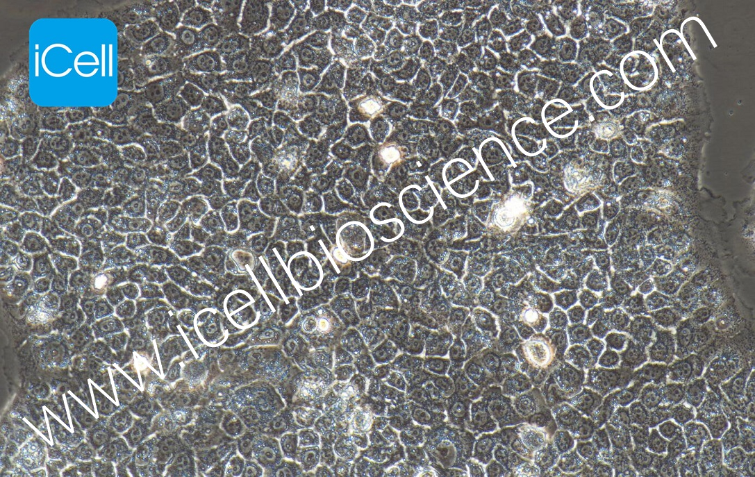 Bxpc-3 人原位胰腺腺癌细胞-原代细胞-STR细胞-细胞培养基-镜像绮点生物