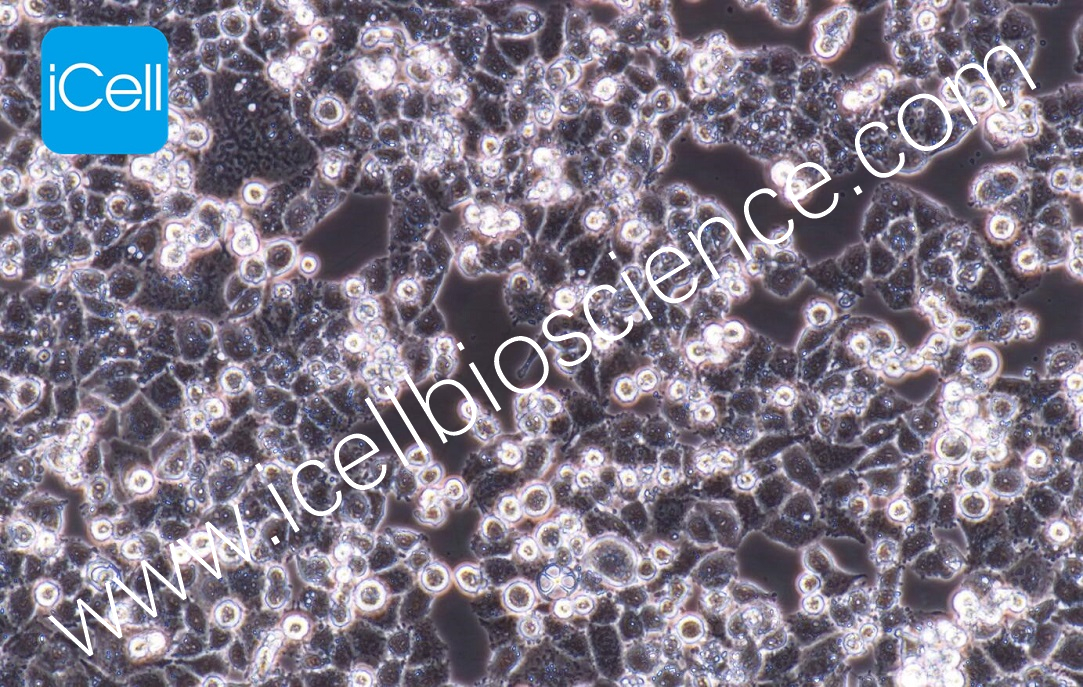 C-33A 人宫颈癌细胞-原代细胞-STR细胞-细胞培养基-镜像绮点生物