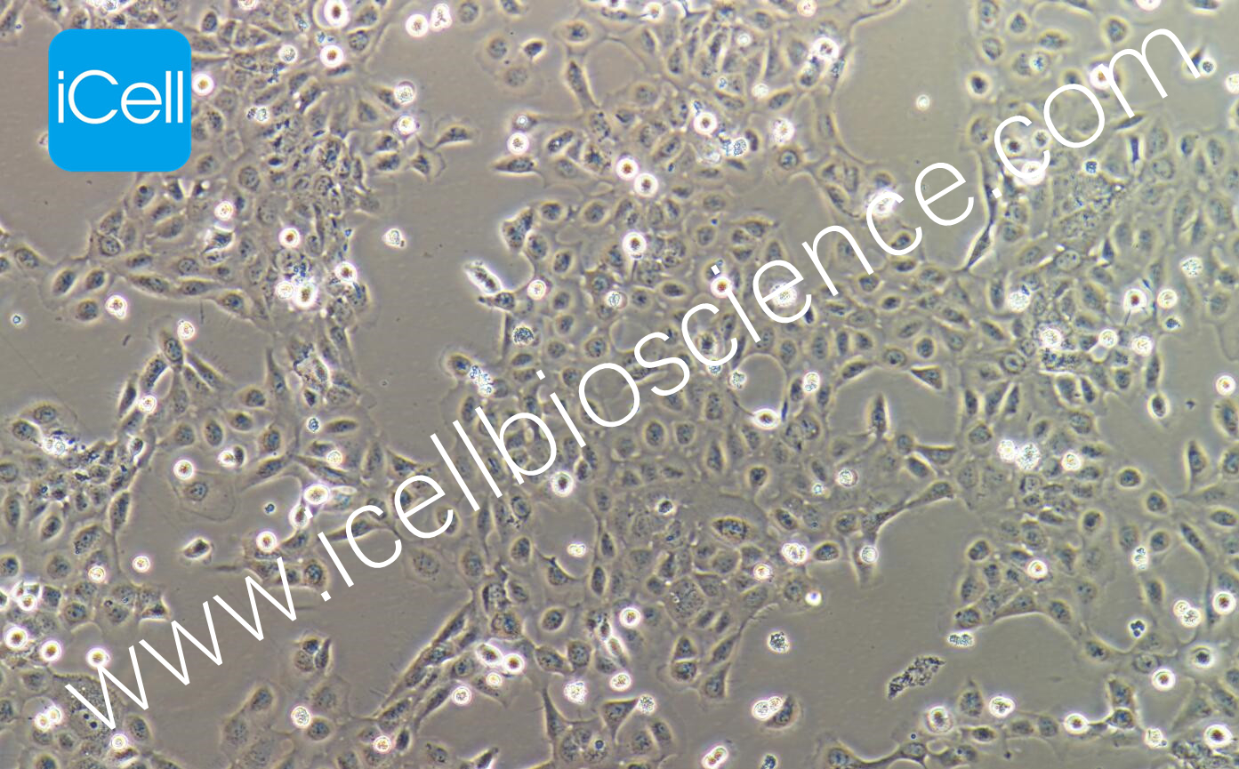 CASKI 人宫颈癌细胞-原代细胞-STR细胞-细胞培养基-镜像绮点生物