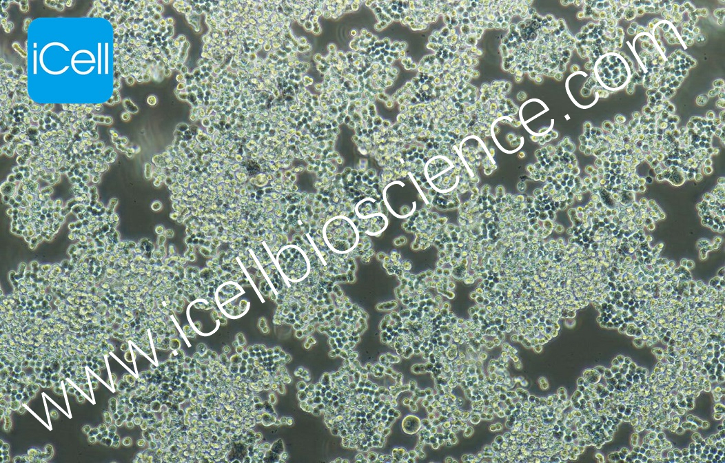 COLO320 人结直肠腺癌细胞-原代细胞-STR细胞-细胞培养基-镜像绮点生物