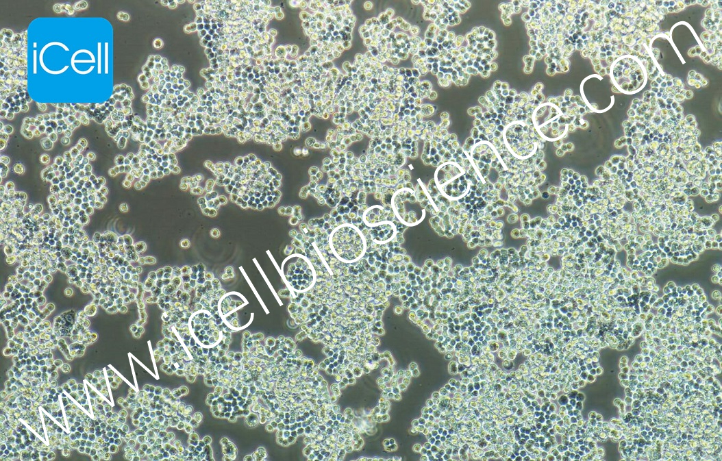 COLO320 人结直肠腺癌细胞-原代细胞-STR细胞-细胞培养基-镜像绮点生物