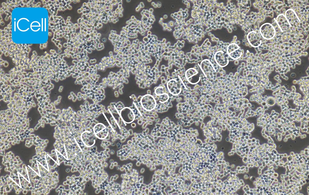 COLO320 DM人结直肠腺癌细胞-原代细胞-STR细胞-细胞培养基-镜像绮点生物