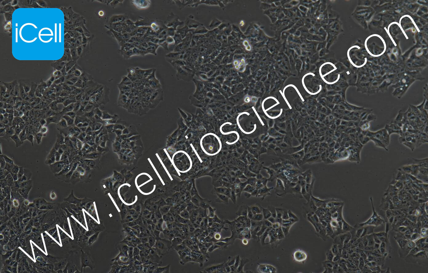DLD-1 人结直肠腺癌上皮细胞-原代细胞-STR细胞-细胞培养基-镜像绮点生物