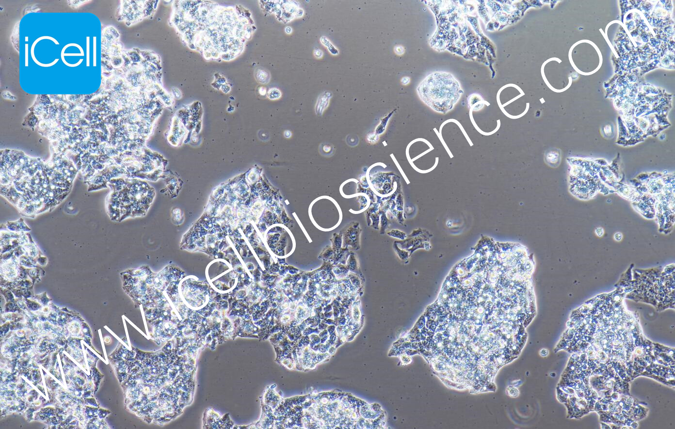 GS-HEPG2 人肝癌细胞亚型-原代细胞-STR细胞-细胞培养基-镜像绮点生物