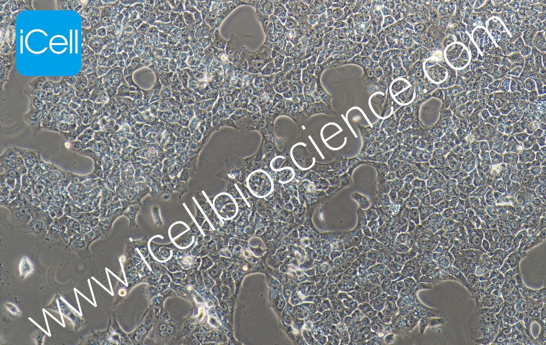 HCC827 人非小细胞肺癌细胞-原代细胞-STR细胞-细胞培养基-镜像绮点生物