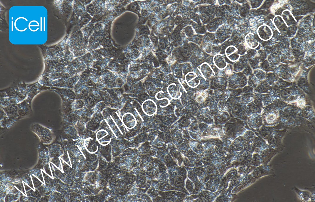 HCC827 人非小细胞肺癌细胞-原代细胞-STR细胞-细胞培养基-镜像绮点生物