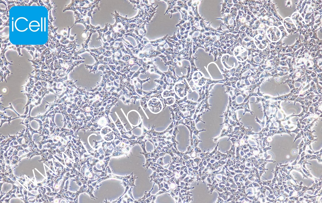 HEK-293T 人胚肾细胞-原代细胞-STR细胞-细胞培养基-镜像绮点生物