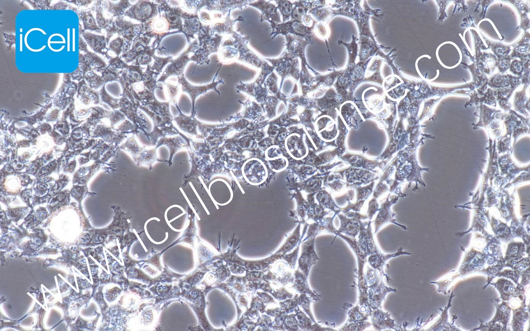 HEK-293T 人胚肾细胞-原代细胞-STR细胞-细胞培养基-镜像绮点生物