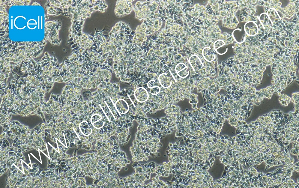 Hep G2.2.15 人肝母细胞瘤细胞-原代细胞-STR细胞-细胞培养基-镜像绮点生物