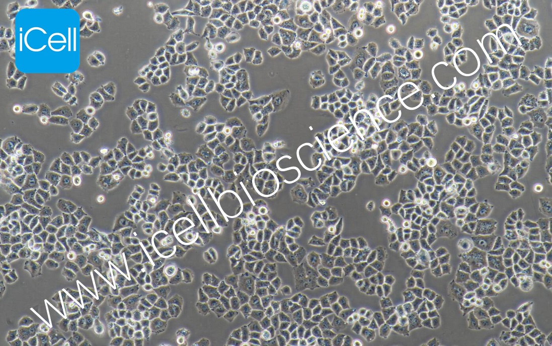 IOSE-80 人正常卵巢上皮细胞-原代细胞-STR细胞-细胞培养基-镜像绮点生物