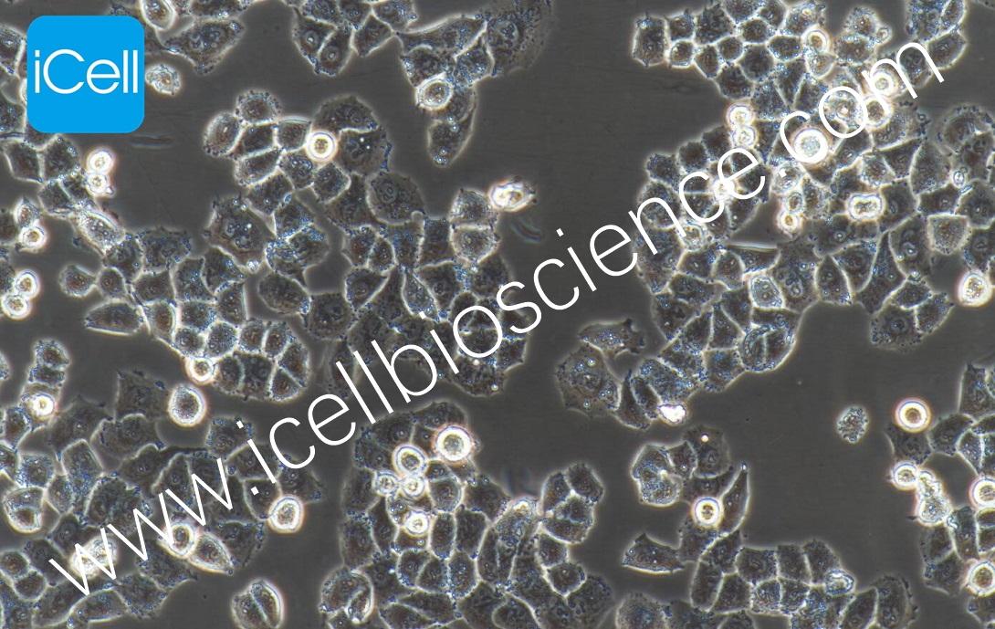 IOSE-80 人正常卵巢上皮细胞-原代细胞-STR细胞-细胞培养基-镜像绮点生物