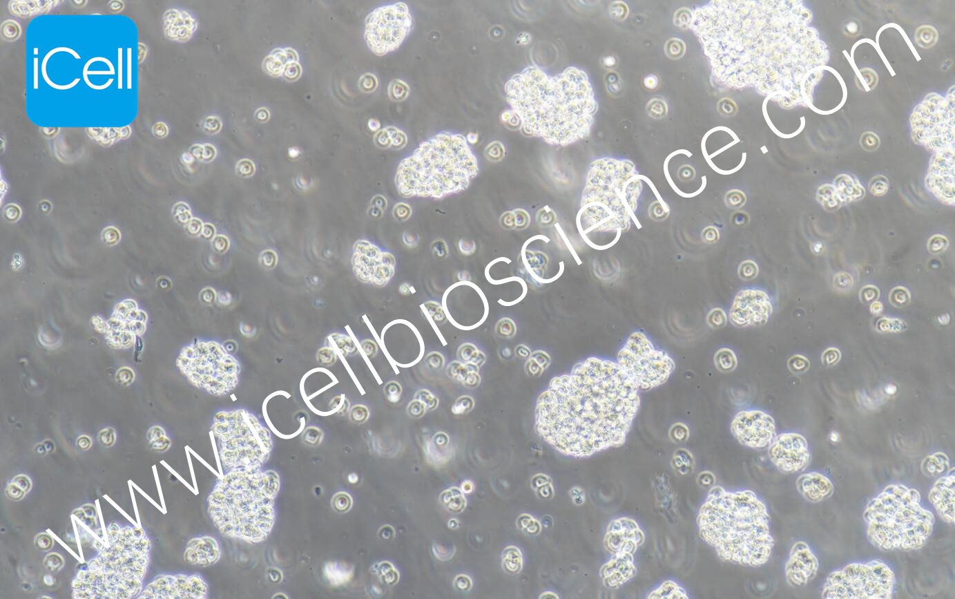 Jurkat（clone E6-1）人T淋巴细胞白血病细胞-原代细胞-STR细胞-细胞培养基-镜像绮点生物