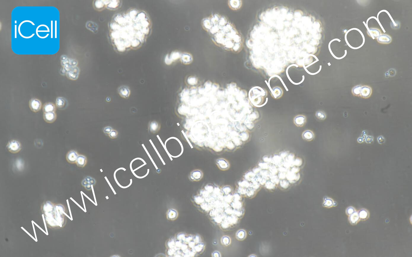 Jurkat（clone E6-1）人T淋巴细胞白血病细胞-原代细胞-STR细胞-细胞培养基-镜像绮点生物