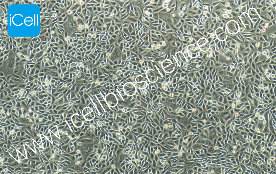 OV-90 人卵巢癌细胞-原代细胞-STR细胞-细胞培养基-镜像绮点生物