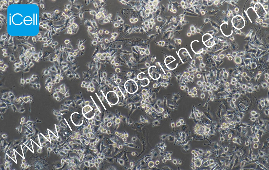 NOZ 人胆囊癌细胞（暂不提供）-原代细胞-STR细胞-细胞培养基-镜像绮点生物