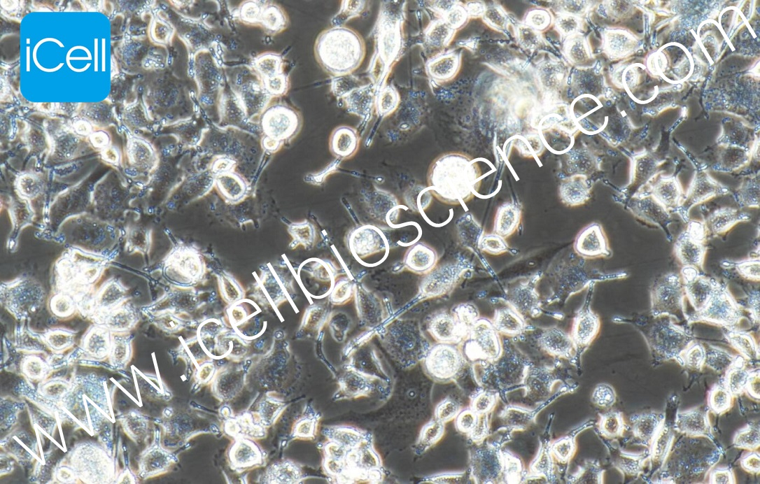 NOZ 人胆囊癌细胞（暂不提供）-原代细胞-STR细胞-细胞培养基-镜像绮点生物