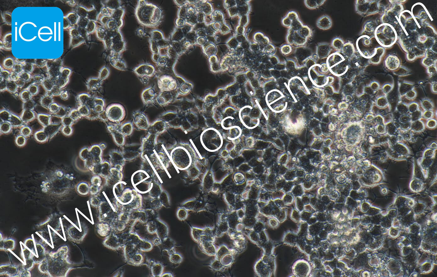 neuro-2a（N2A）小鼠脑神经瘤细胞-原代细胞-STR细胞-细胞培养基-镜像绮点生物