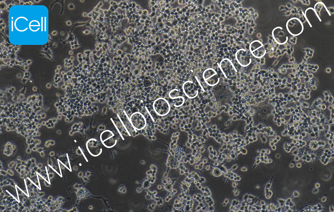neuro-2a（N2A）小鼠脑神经瘤细胞-原代细胞-STR细胞-细胞培养基-镜像绮点生物