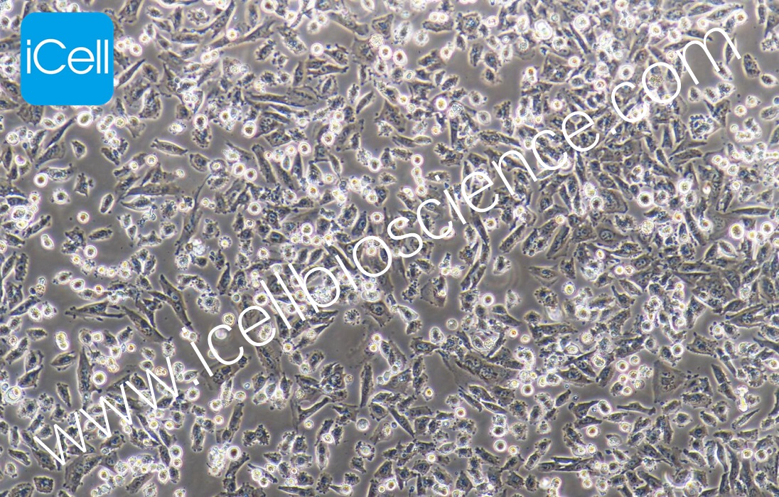 NCI-H1703 人肺鳞癌细胞-原代细胞-STR细胞-细胞培养基-镜像绮点生物
