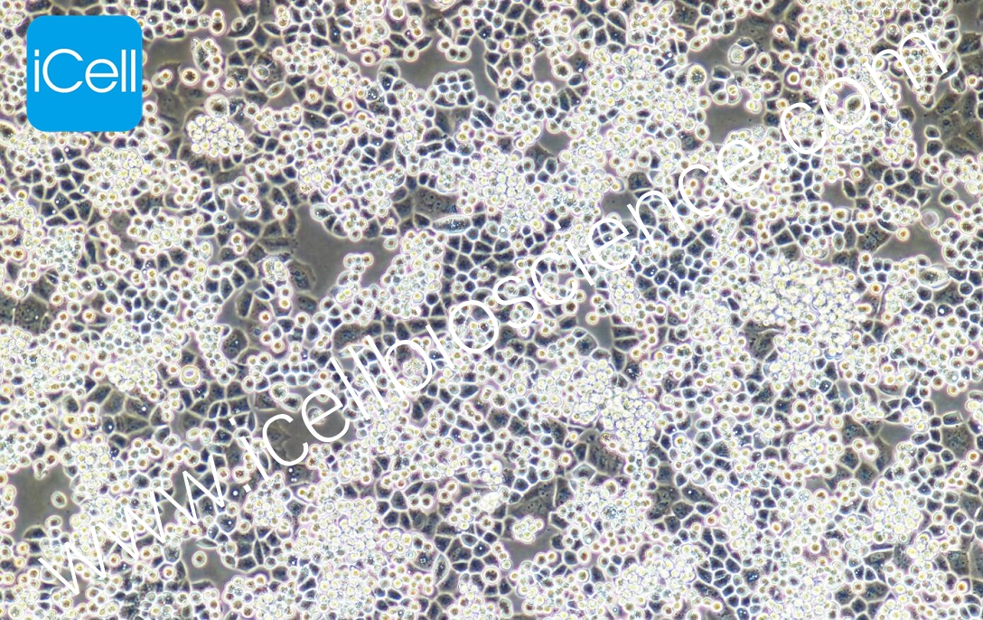 MDA-kb2 人乳腺癌细胞-原代细胞-STR细胞-细胞培养基-镜像绮点生物