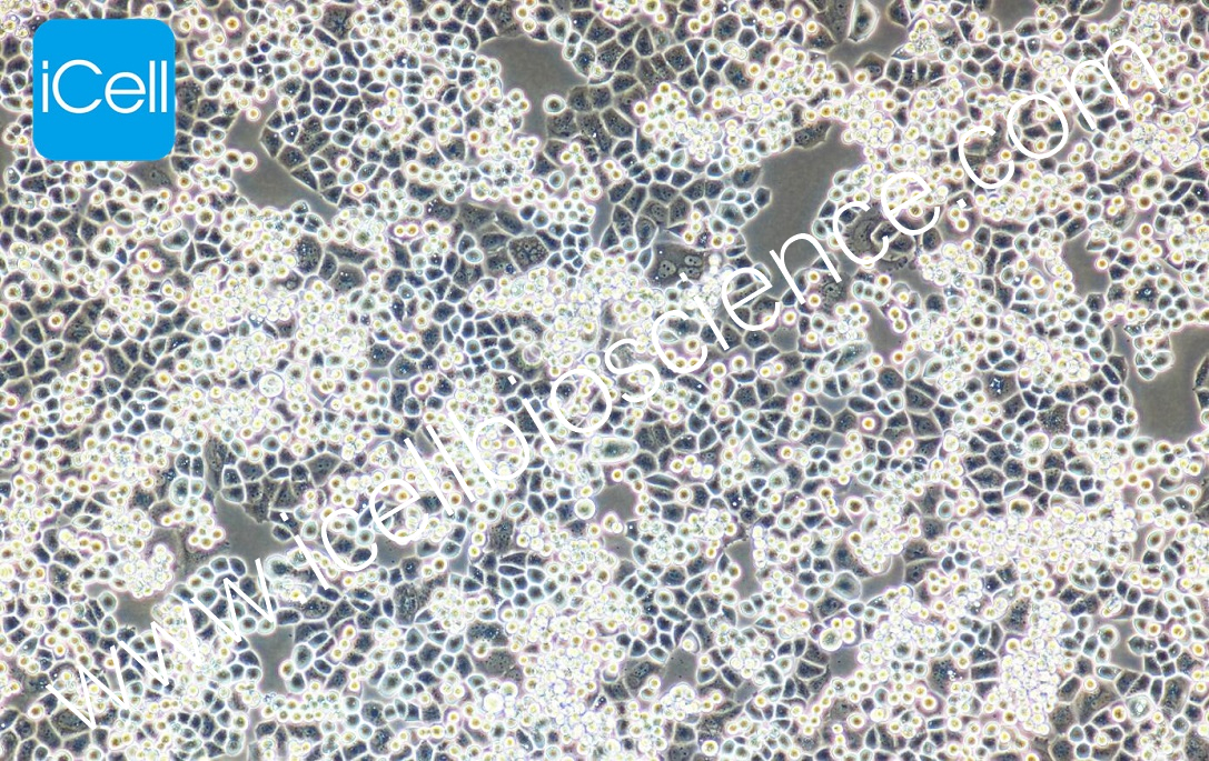MDA-kb2 人乳腺癌细胞-原代细胞-STR细胞-细胞培养基-镜像绮点生物