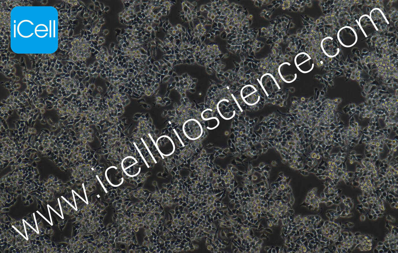 LS174T 人结直肠腺癌细胞-原代细胞-STR细胞-细胞培养基-镜像绮点生物