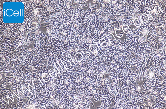 P53R 人结直肠癌细胞 -原代细胞-STR细胞-细胞培养基-镜像绮点生物