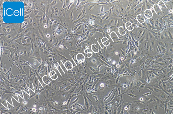 J82 人膀胱移行细胞癌-原代细胞-STR细胞-细胞培养基-镜像绮点生物