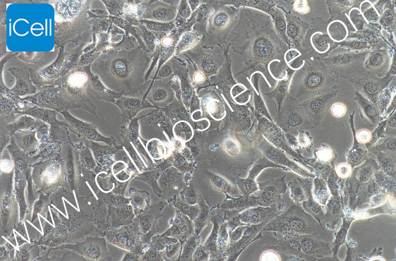 J82 人膀胱移行细胞癌-原代细胞-STR细胞-细胞培养基-镜像绮点生物
