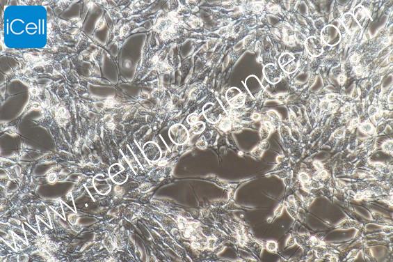 4T1+luc 小鼠乳腺癌细胞+luc-原代细胞-STR细胞-细胞培养基-镜像绮点生物