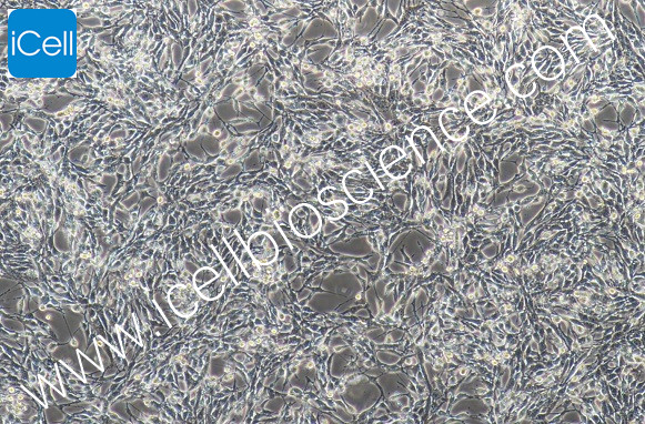 4T1+luc 小鼠乳腺癌细胞+luc-原代细胞-STR细胞-细胞培养基-镜像绮点生物