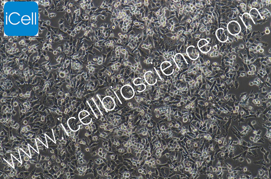 PATU 8988S 人胰腺癌细胞 （暂不提供）-原代细胞-STR细胞-细胞培养基-镜像绮点生物