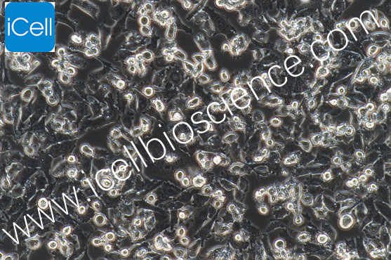 PATU 8988S 人胰腺癌细胞 （暂不提供）-原代细胞-STR细胞-细胞培养基-镜像绮点生物