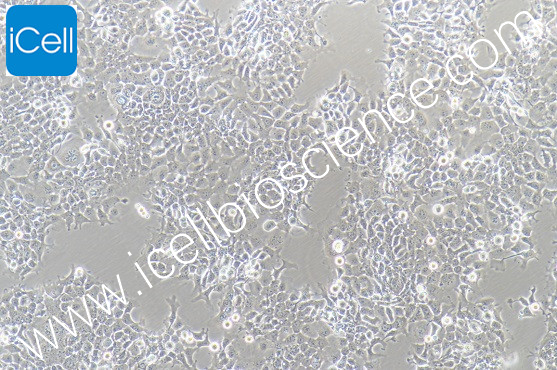FADU 人咽鳞癌细胞-原代细胞-STR细胞-细胞培养基-镜像绮点生物