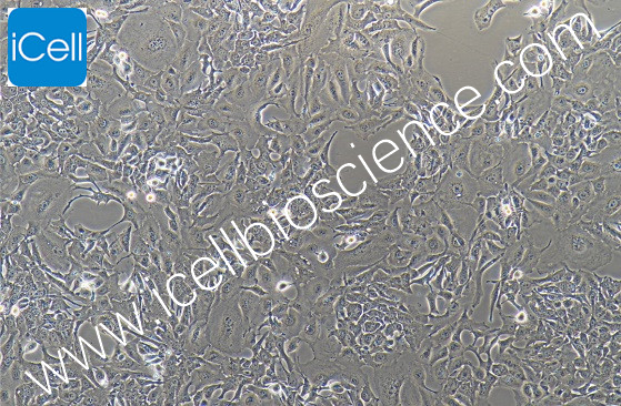 hccc-9810 人胆管细胞型肝癌细胞-原代细胞-STR细胞-细胞培养基-镜像绮点生物
