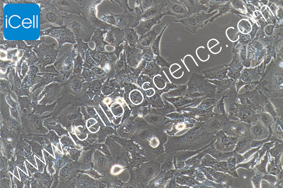 hccc-9810 人胆管细胞型肝癌细胞-原代细胞-STR细胞-细胞培养基-镜像绮点生物