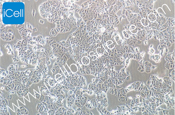 MCF-7+luc 人乳腺癌细胞+luc-原代细胞-STR细胞-细胞培养基-镜像绮点生物