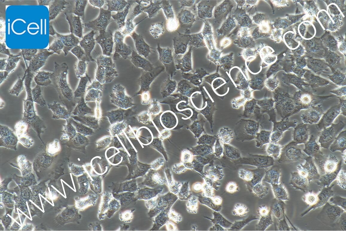 MUM2B 人侵袭性脉络膜黑色素瘤细胞-原代细胞-STR细胞-细胞培养基-镜像绮点生物