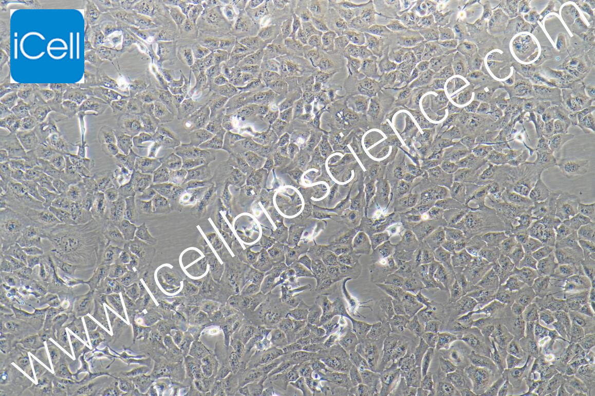RBE 人肝胆管癌细胞-原代细胞-STR细胞-细胞培养基-镜像绮点生物