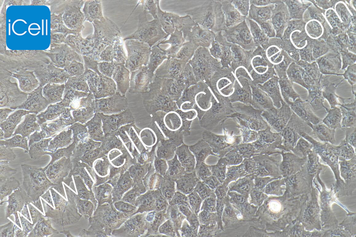 RBE 人肝胆管癌细胞-原代细胞-STR细胞-细胞培养基-镜像绮点生物
